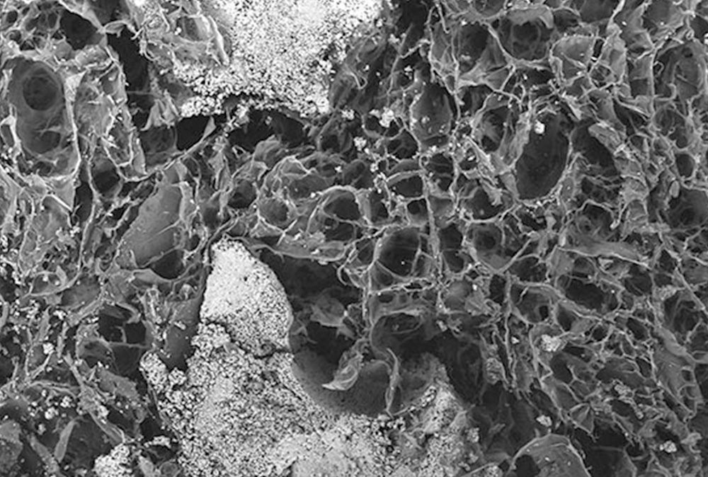 Bone Graft Substitute - Wiltrom Co., Ltd.